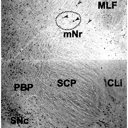 Human magnocellular red nucleus.