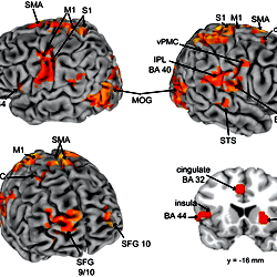 Brain activations as a function of the tempo of the expressive performance.
