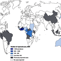 A global map representing countries that have reported cases of Buruli ...