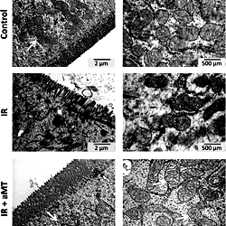 Electron microscopy (EM) analysis.