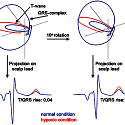 The fetal vectorcardiogram for different orientations of the electrical ...