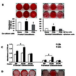 Effects of interactions between FOb and POb cells on cell proliferation ...