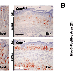 Immunostaining for inflammatory cells in chest and ear skin tumor sections.