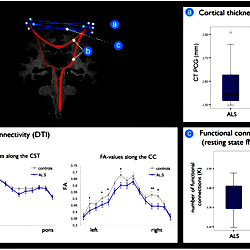 Overview of motor network measures.