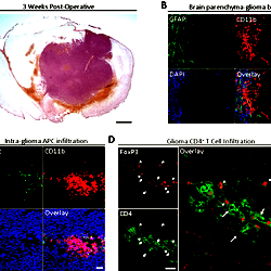 A mouse brain that received an intracranial injection of GL261 cells.