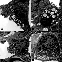 Ultrastructure of Alveolar Epithelial cells type II (AEII).