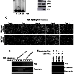 TG2 is a downstream mediator of TGF-β-induced EMT.