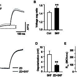 Effects of SKF83959 on subthreshold response of CA1 pyramidal neurons.
