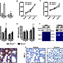 MMP activity in each experimental group.