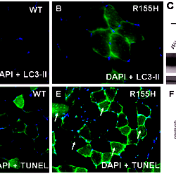 LC3-II staining, protein expression and apoptosis detection in the wild ...