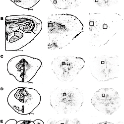 Brightfield images (left column) and inverted darkfield images of ...