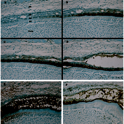 The p120 null ameloblasts detach from the incisor dentin surface, the ...