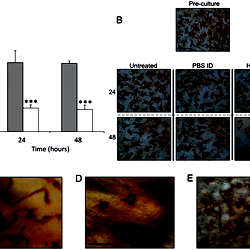 Changes in LC numbers and morphology in epidermal sheets.