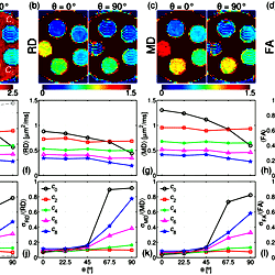 Maps of the DTI scalar parameters.