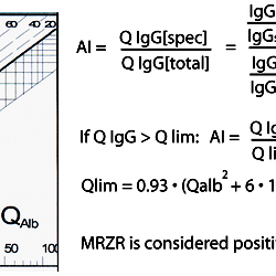 Reiber diagram and antibody index.