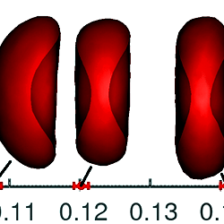 Different RBC shapes.
