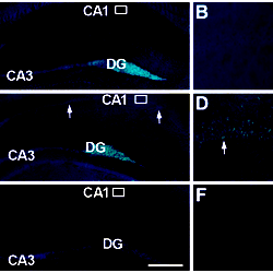 TSQ staining showing the zinc chelating effect of CQ in the gerbil ...