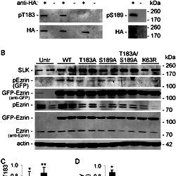 T183A, S189A, T183A/S189A and K63R mutations in the SLK activation ...