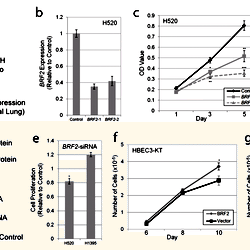 BRF2 activation contributes to cell growth and proliferation.