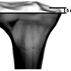 Simulated AORI Type I resection using a template, located 5 mm distal ...