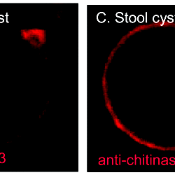 Antibodies to EhJacob2, Jessie3, and chitinase bind to Entamoeba cysts ...