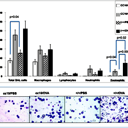 BAL Cell Counts.