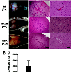Infection of DBA/2 with P. berghei ANKA does not cause brain damage.