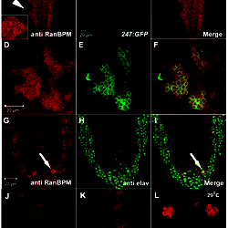 RanBPMlong is highly expressed in the Kenyon cells of the mushroom body.