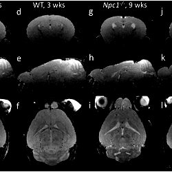 Example anatomical MRI images of mice at early and late timepoints.