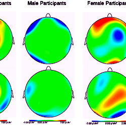 Current Source Density (CSD) maps.