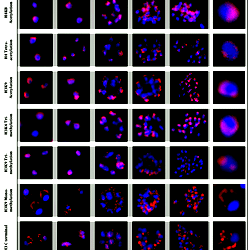 Immunofluorescence analysis of histone modifications in P. falciparum.