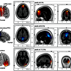EEG source localization (sLORETA) activation maps for the contrast ‘ss5 ...