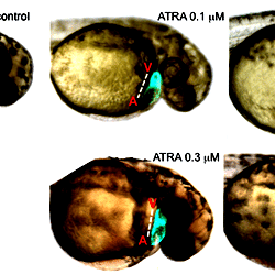 BT10 added at 24 hpf causes a defect in heart tube looping, similar to ...