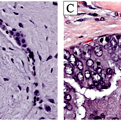 Examples of microscopy image patches from the used dataset [3].