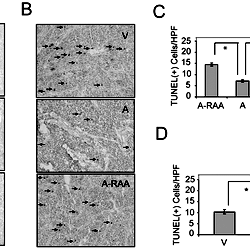 TUNEL staining in MiaPaCa-2 and HT1080 tumor tissues.