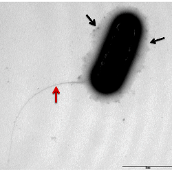 Electron microscopy showing the presence of capsule like structures.