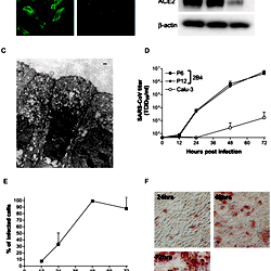 Characteristics of 2B4 cells clonally derived from human bronchial ...