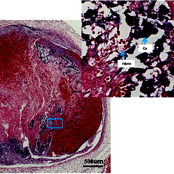 Pathological images of a thrombus cross-section scanned by an automatic ...