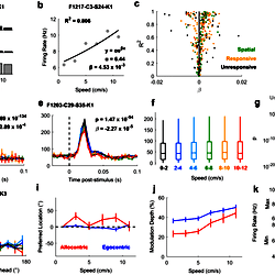 Speed-related auditory cortical activity and sensory processing.