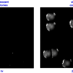 Comparing the number and pattern of microcolonies detected by the ...
