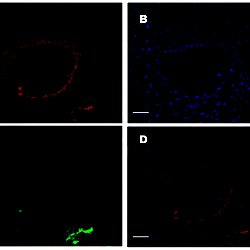 Blood and lymphatic identification in onchocercoma.