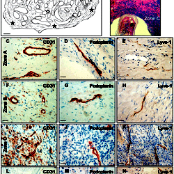 Vascular organisation of onchocercoma.