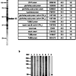 Identification and characterization of proteins contain in the section 10.