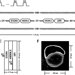 Schematic representation of the 1D strand and 2D regular and realistic ...