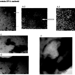 MsDps2 forms protein-DNA nucleoid-like structures under transmission ...