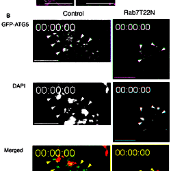 Localization of GFP-Atg5.