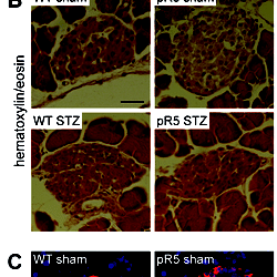 Effects of streptozotocin (STZ) administration in mice.
