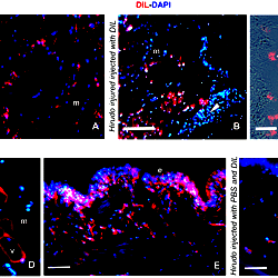 Dil-Ac-LDL uptake by myoendothelial cells located in the interstitial ...