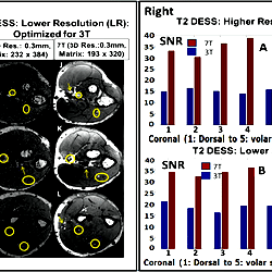 Ultra-high field upper extremity peripheral nerve and non-contrast ...