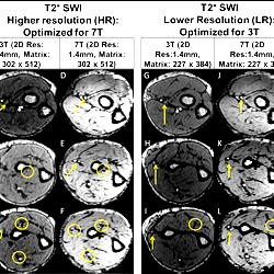 Ultra-high field upper extremity peripheral nerve and non-contrast ...